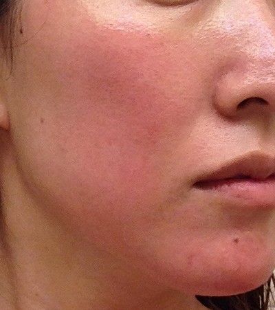 Why Use Good Face Toner For Sensitive Skin – MadebyAnjoe